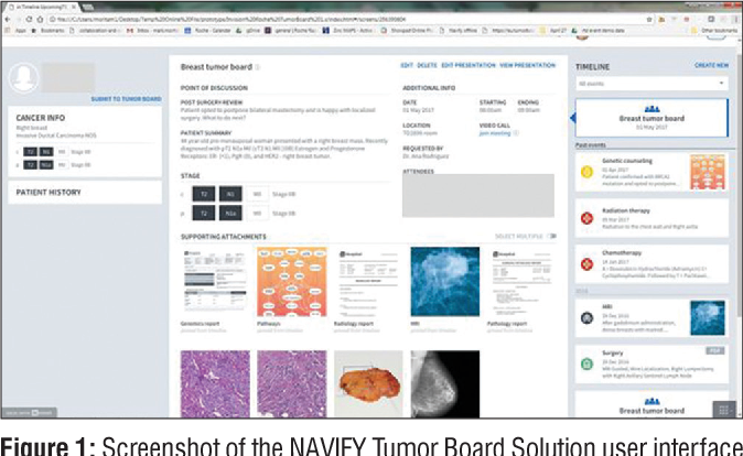 Retrospect the Path of Tumor Board Collaborative Platform | by Aijli ...