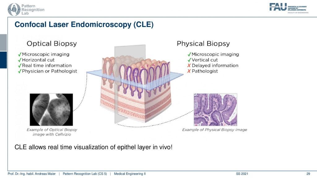 Endoscopy — A Deep View into the Human Body — Part 2 | by Andreas Maier ...