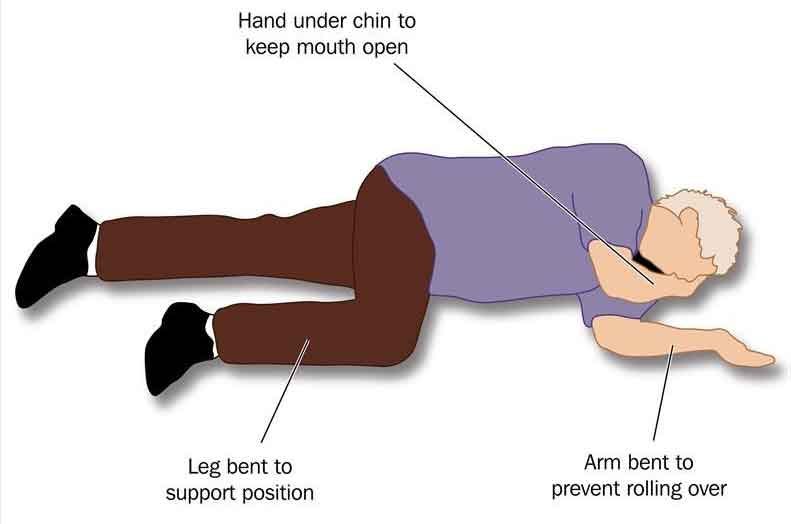 First Aid for Strokes. In a previous post , I highlighted… | by ...