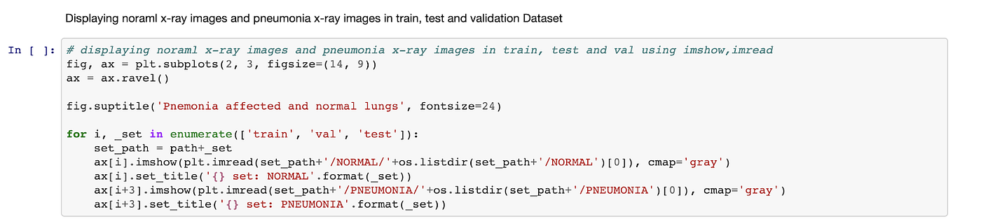 Pneumonia Diagnosis Using Deep Learning Techniques | by Khulood Nasher ...