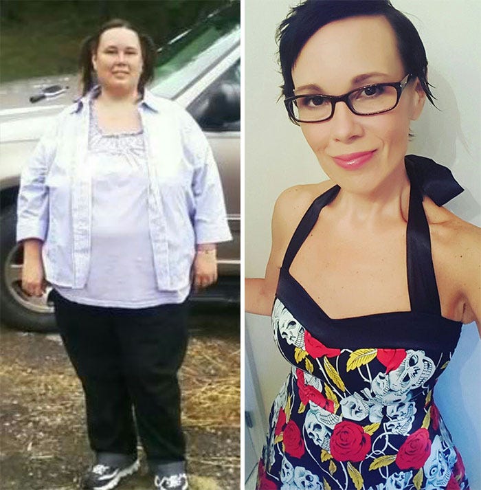10 Breathtaking Before-And-After Weight Loss Pics You Wont Feel Show ...