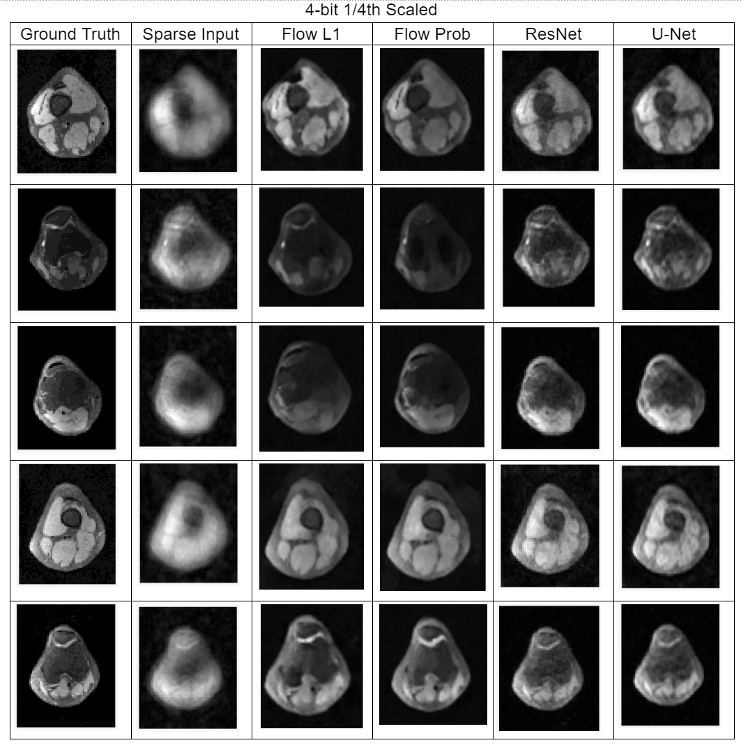 Improving Undersampled MRI with Deep Learning | by Menelaos Kaskiris ...