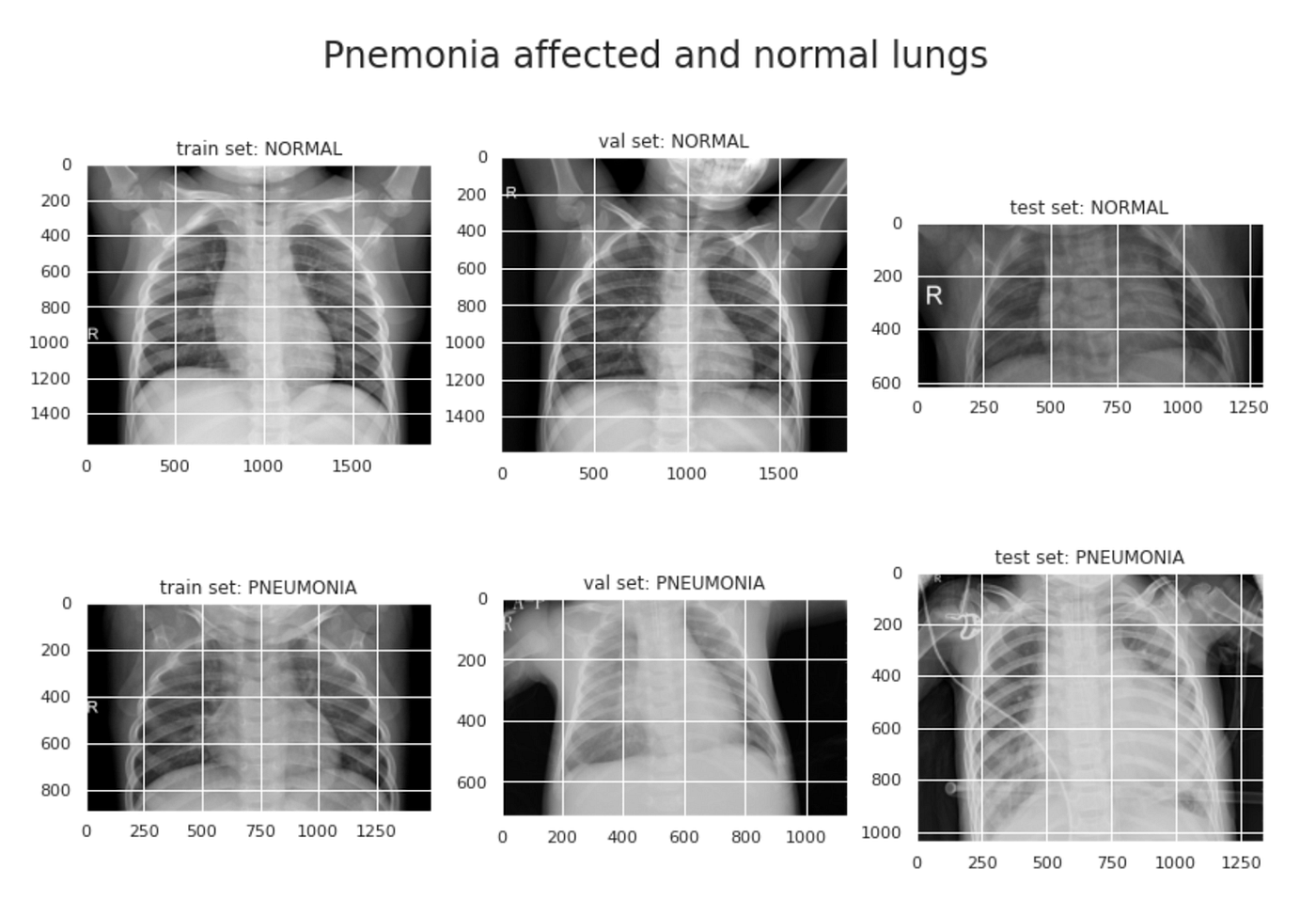 Pneumonia Diagnosis Using Deep Learning Techniques | by Khulood Nasher ...