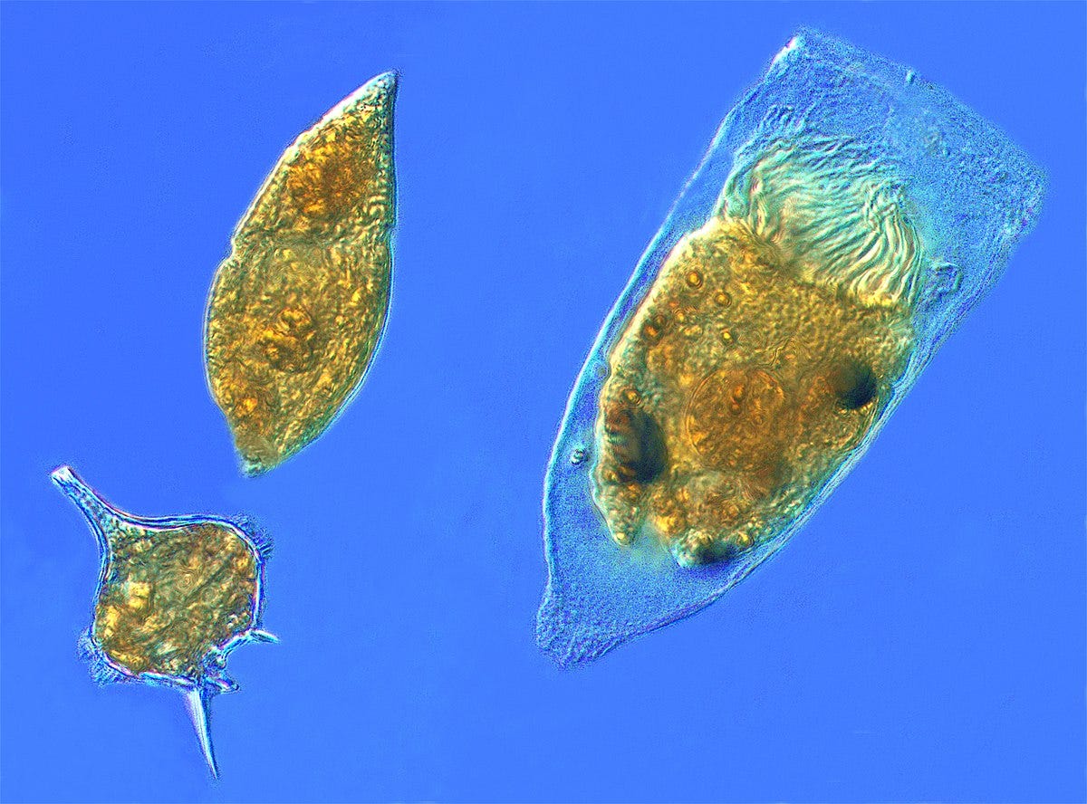 Microbe Profiles: Tintinnids. Eukarya:Ciliophora:Spirotrichea:Choreotr ...