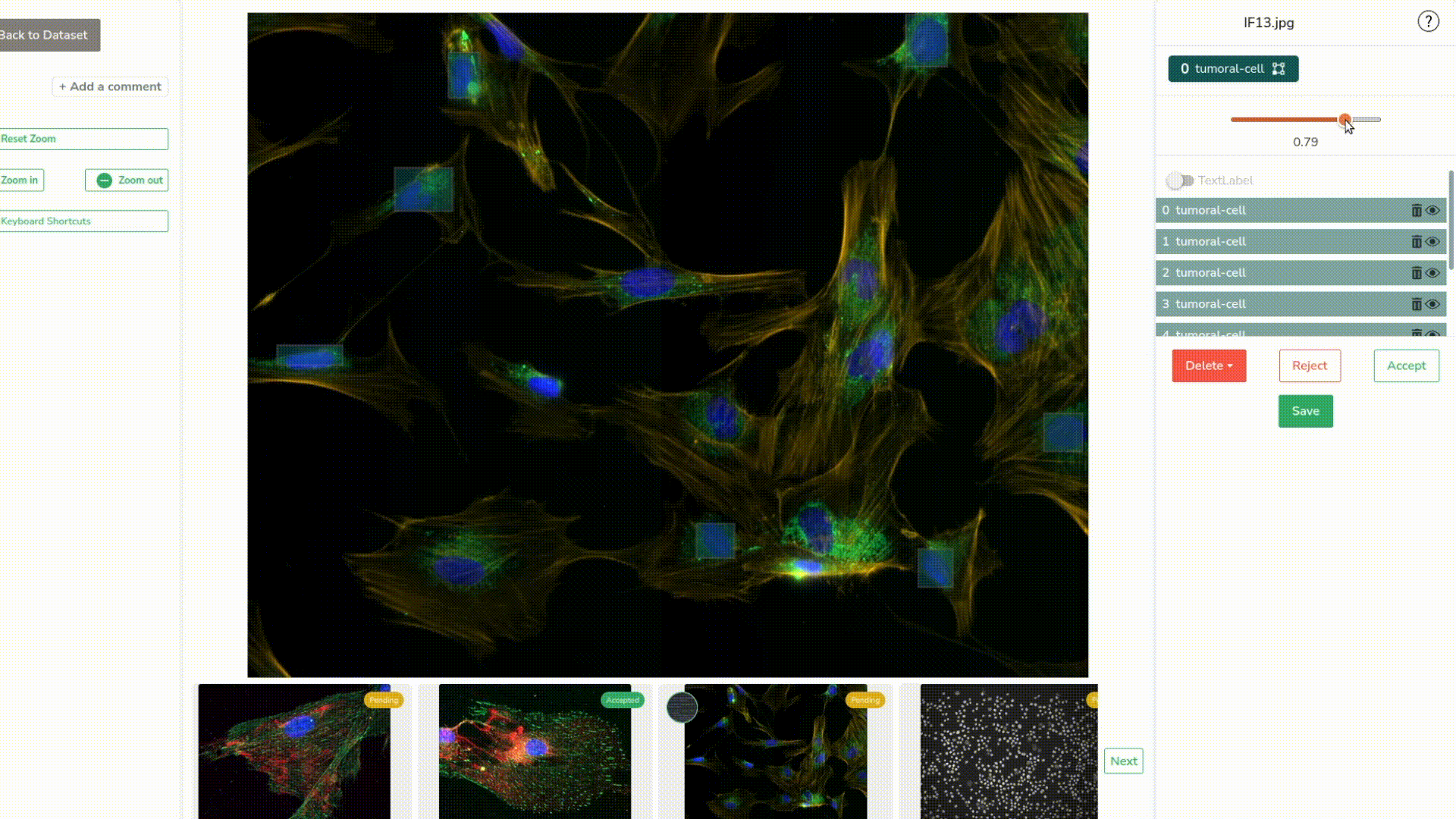 MLOps Applied: How to Use Computer Vision in Cancer Cell Research | by ...