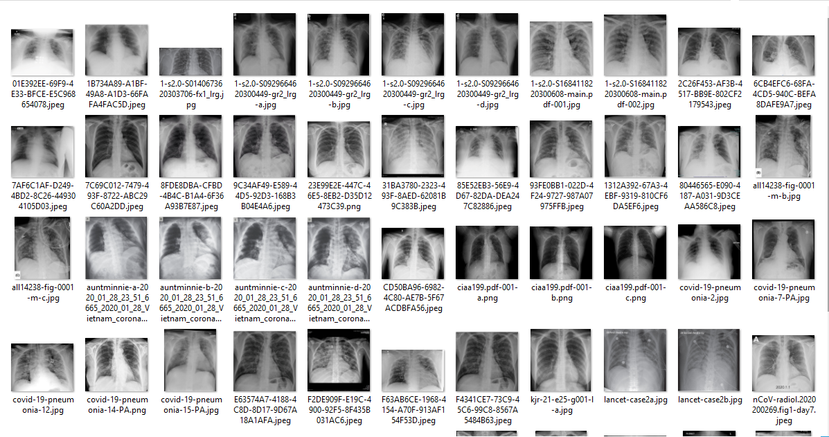 COVID-19 X-Ray Data set — Preprocessing of the data set to train a CNN ...