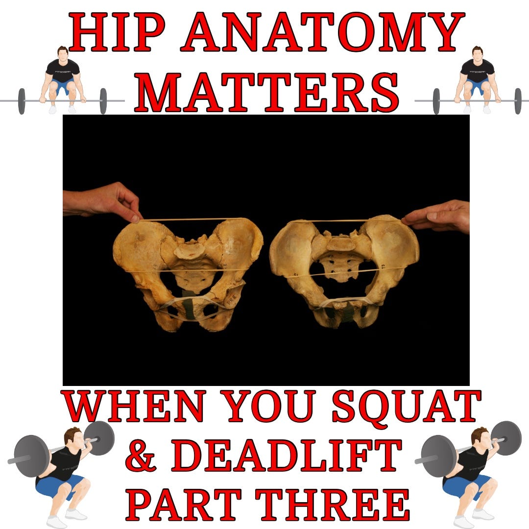 Hip Anatomy Matters When You Squat and Deadlift | by Rafal Matuszewski ...