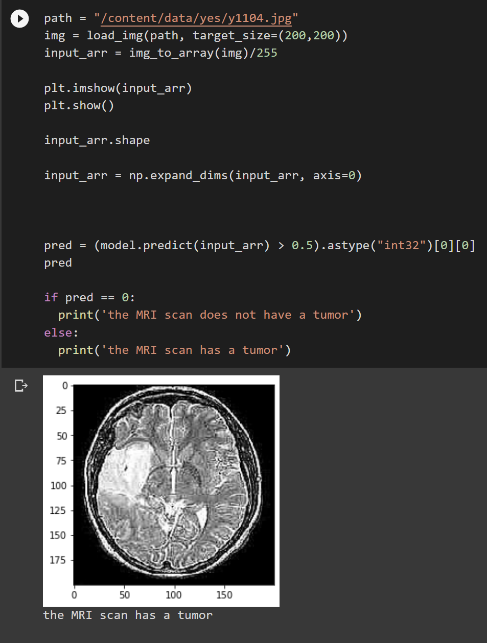 Brain Tumor Detection using Deep Learning | by Odeyemi Ibukun Akinola ...