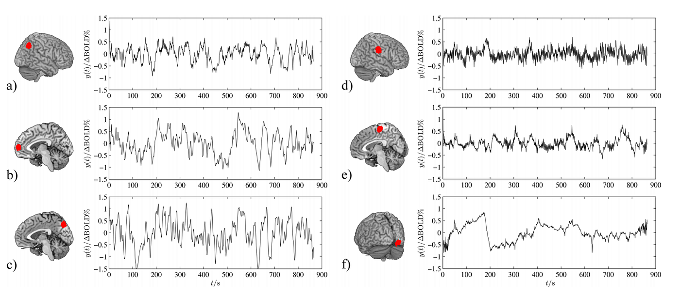 Graph Theory & Machine Learning in Neuroscience | by Mikey Taylor | The ...