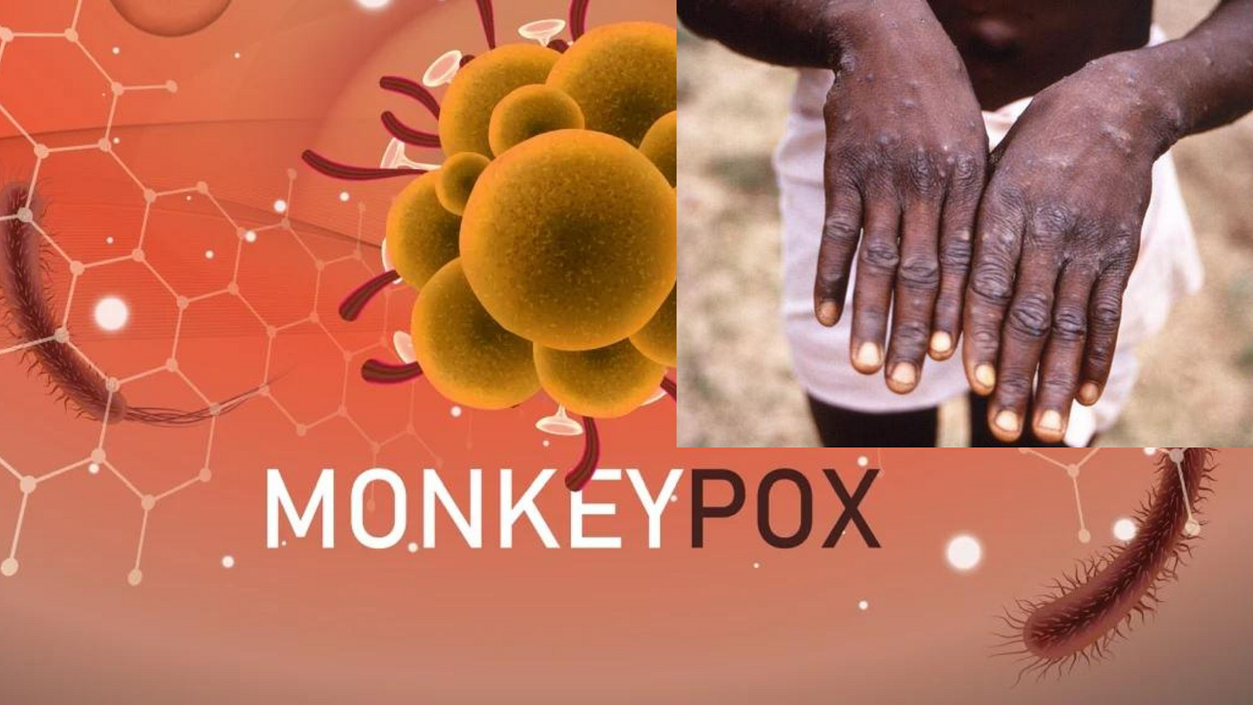 The Early Signs of Monkeypox That Must be Watched Out for Day -by- Day ...