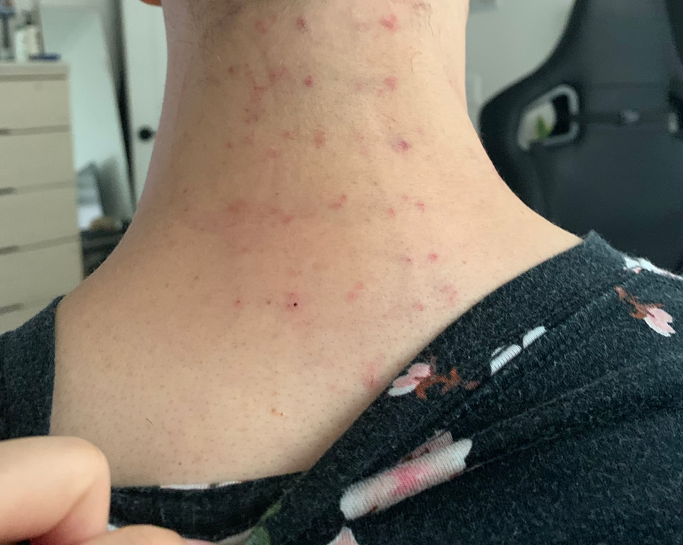 How Prolotherapy Cured 10 Years of Chronic Neck Pain | Ascent Publication