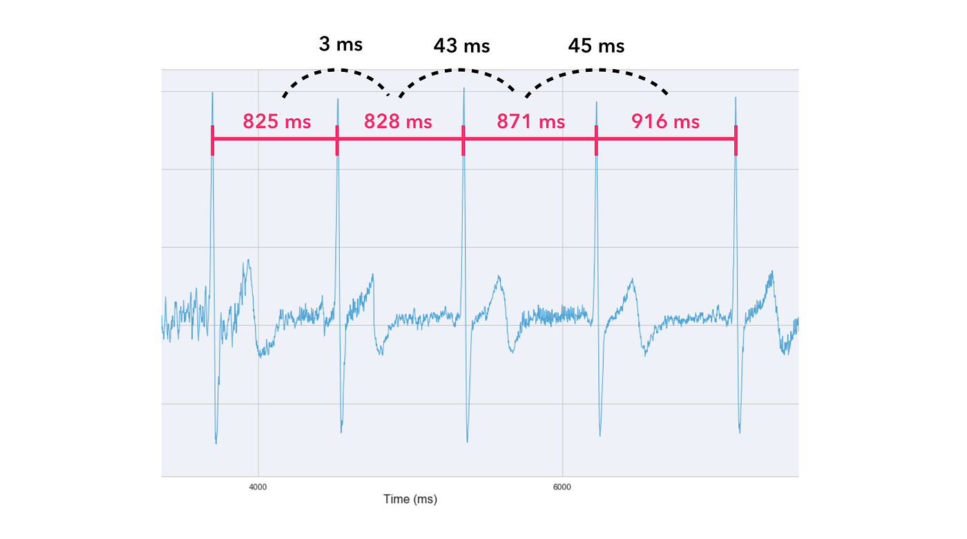 Exploring Heart Rate Variability using Python | by Salomon Tetelepta | Orikami blog | Medium