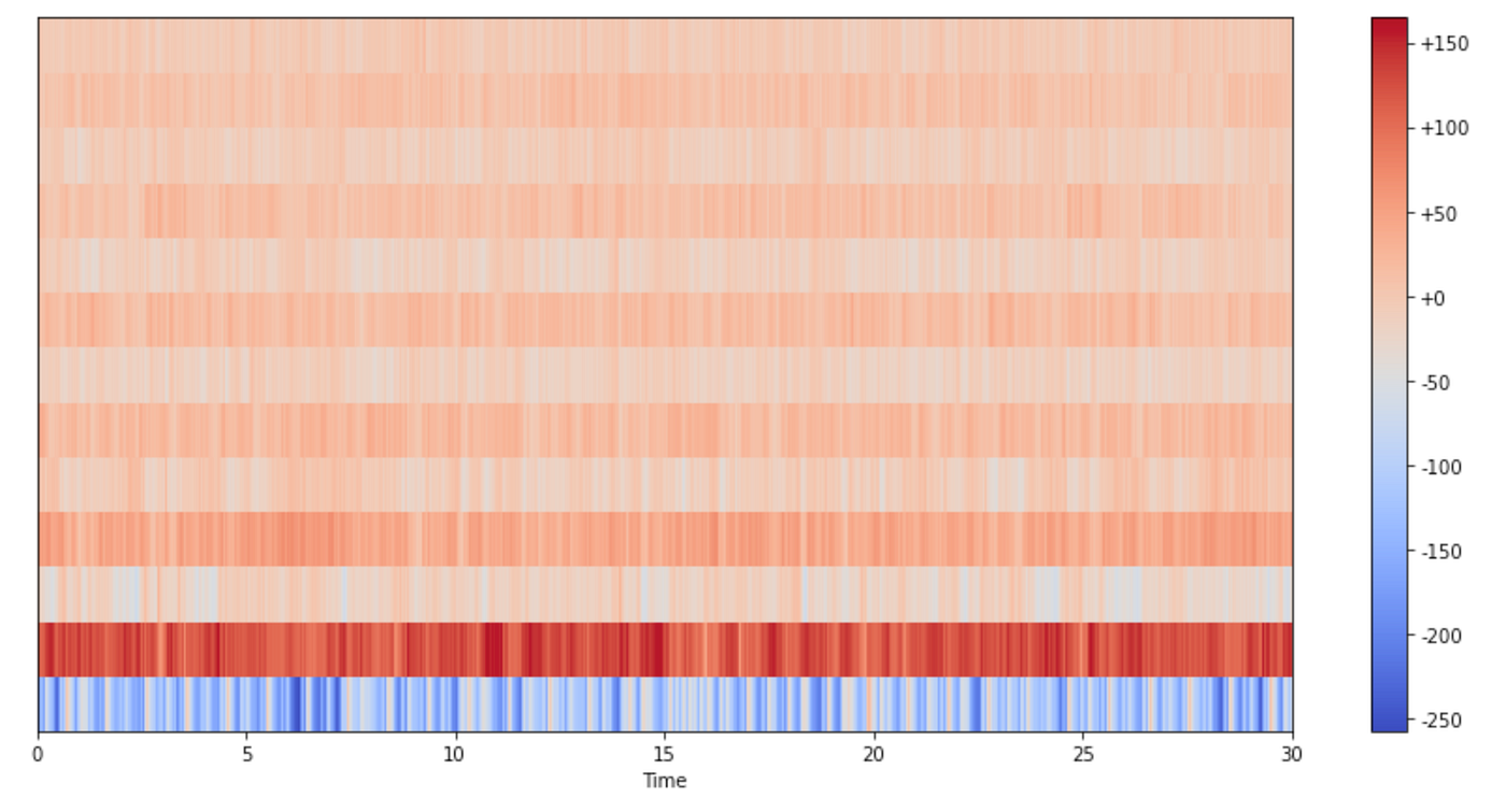 Music Genre Detection With Deep Learning | by Marc Saint-Félix ...