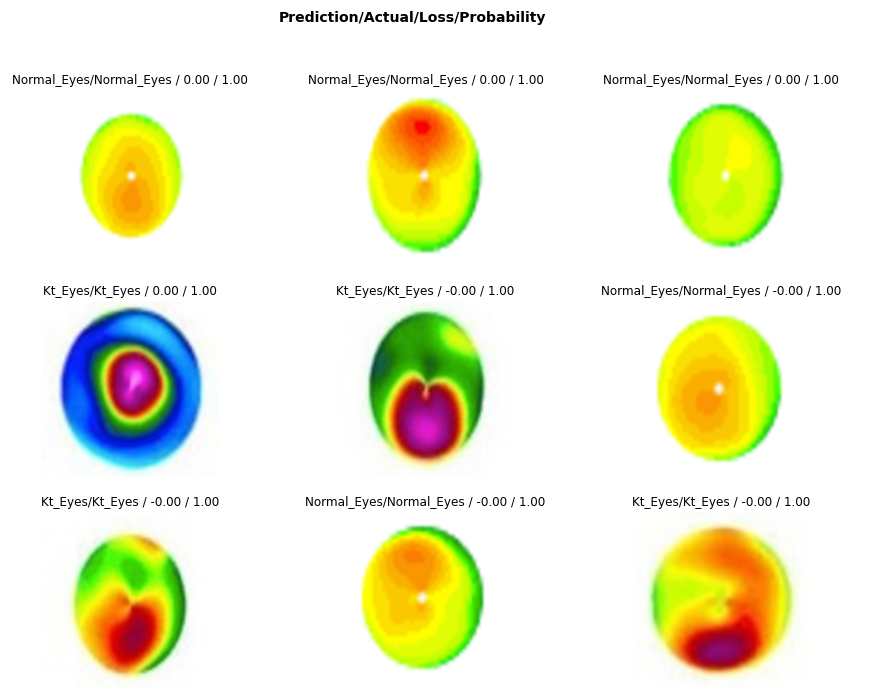 Detecting Keratoconus from Corneal Imaging using Deep Learning | by Gerald Muriuki | Medium