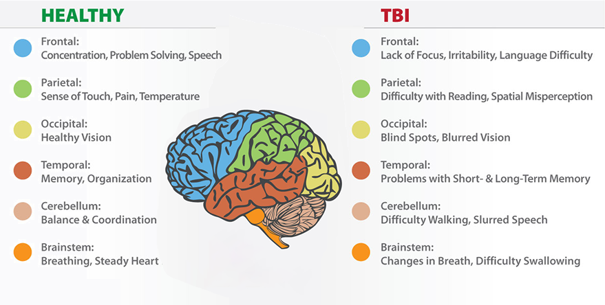 Traumatic Brain Injury — My Argument Against Current CDC Return to Play ...