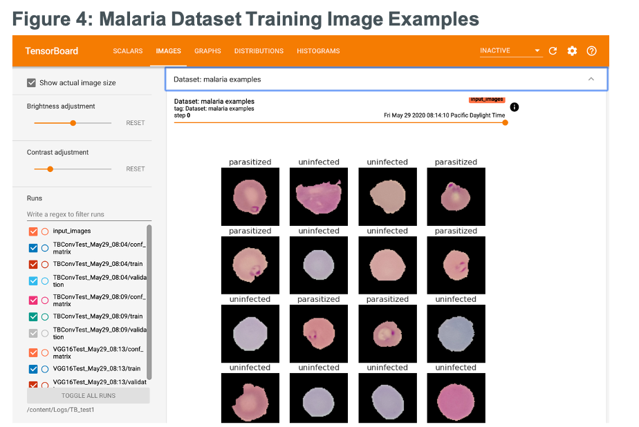 A Tensorflow Modeling Pipeline Using Tensorflow Datasets And Tensorboard By Stephen Godfrey 7658
