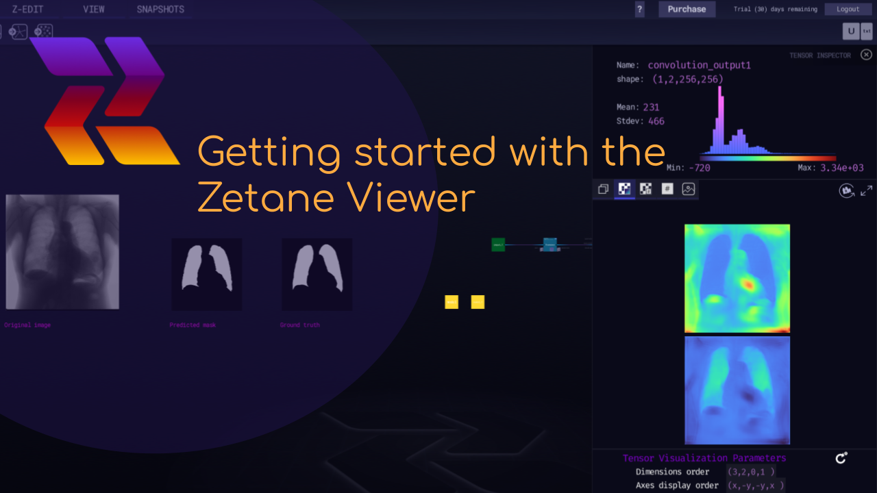 See Machine Learning Models with Unprecedented Detail: Getting Started with the Viewer | by ...