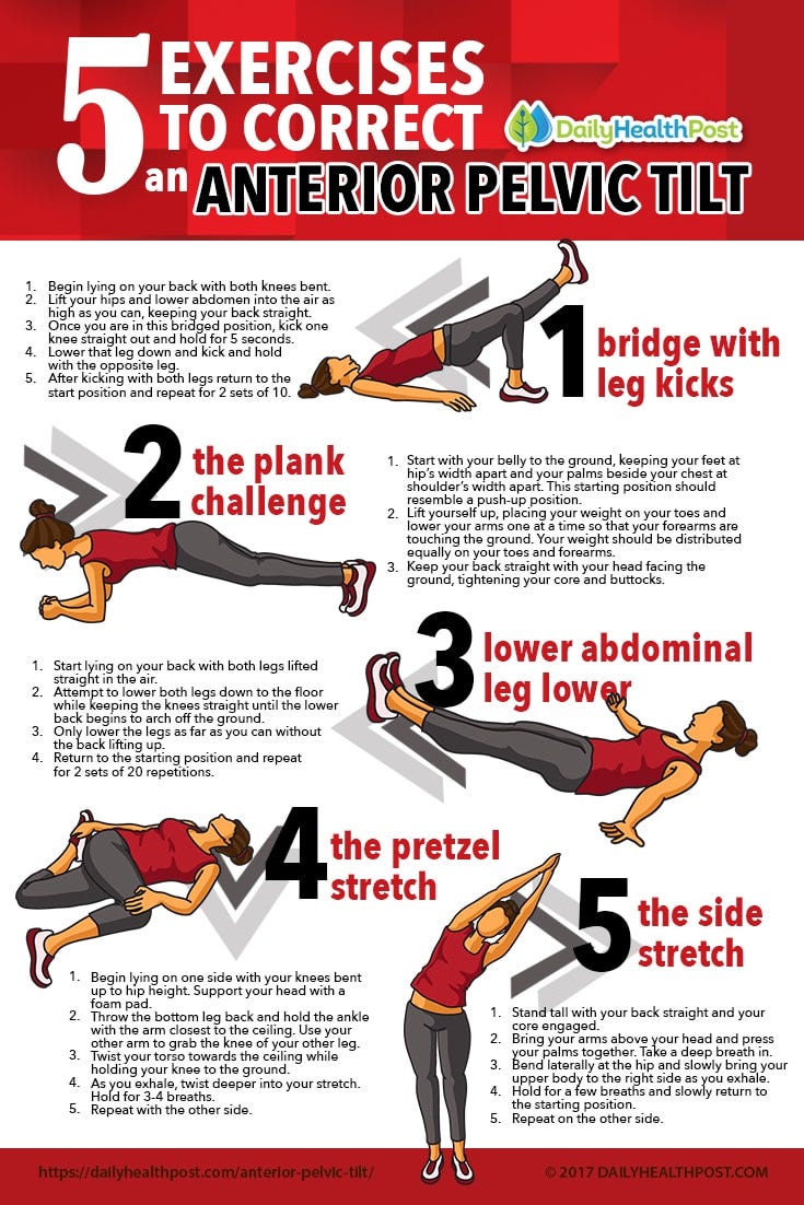 How To Correct an Anterior Pelvic Tilt | by Sworkit | Medium