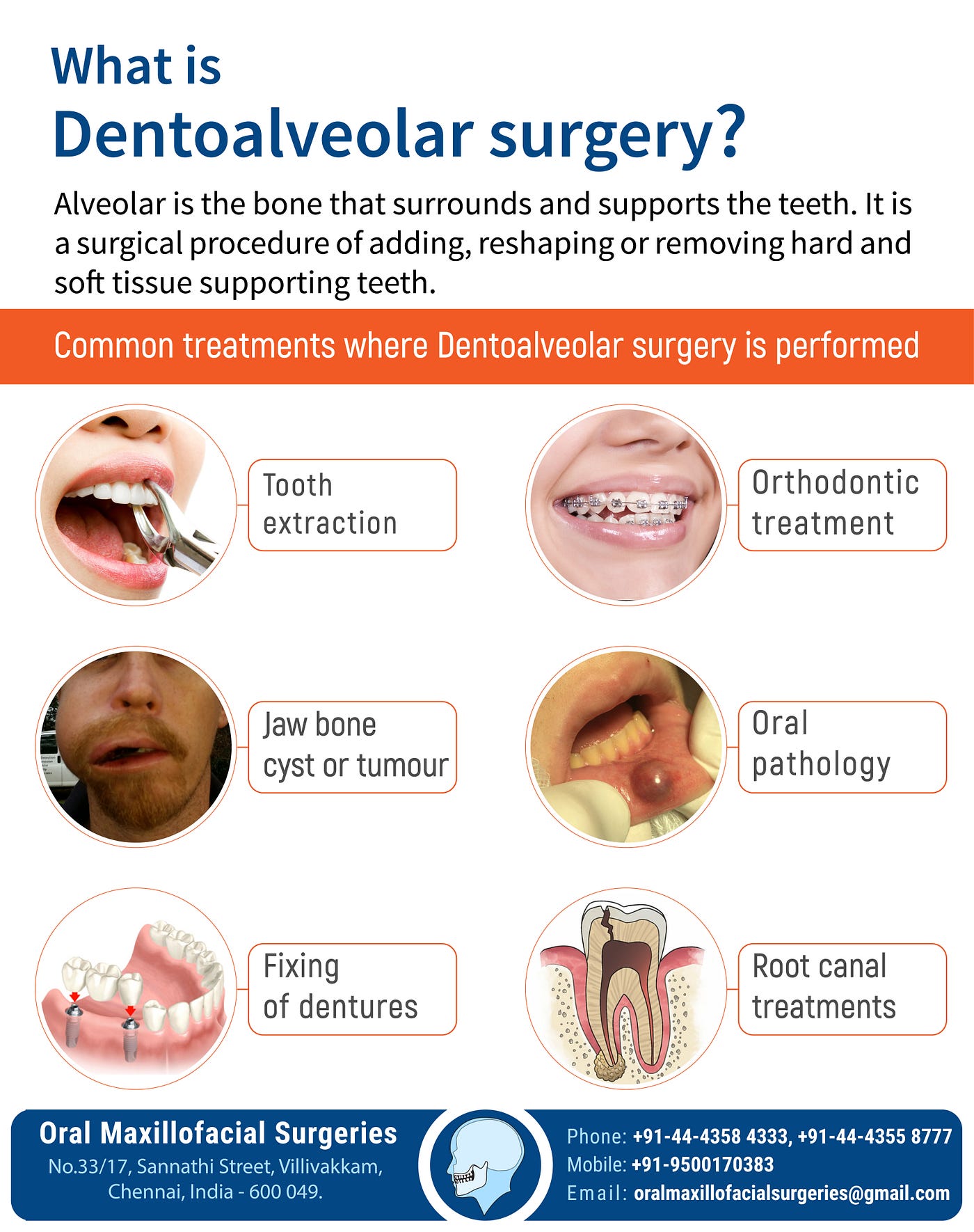 What is Dentoalveolar Surgery?. Alveolar is the bone surrounds and ...