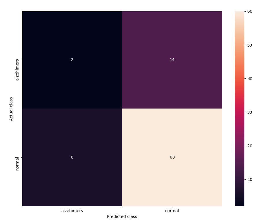 How to get started with deep learning using MRI data. | by Divya Gaur ...