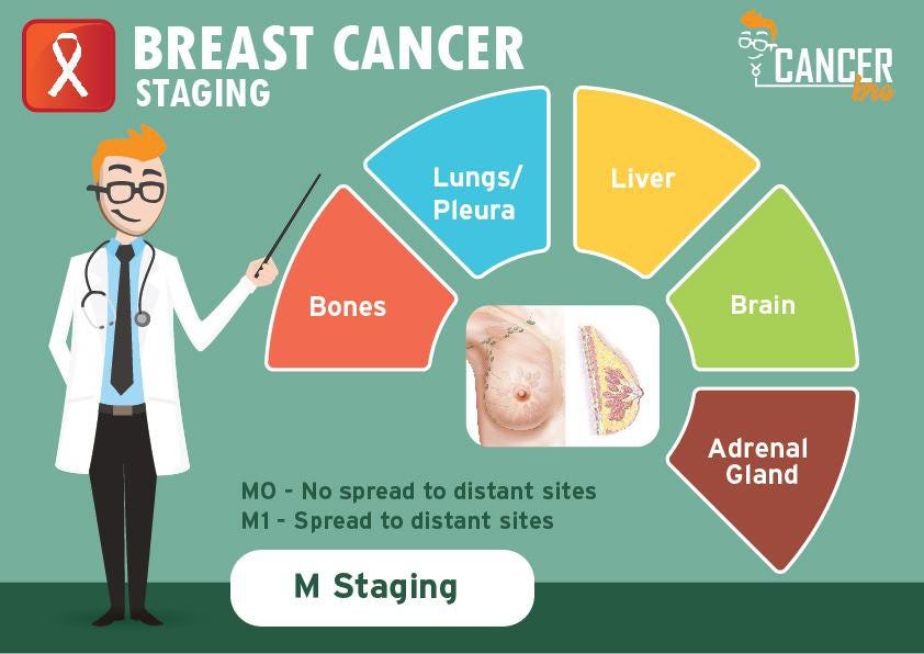 Breast Cancer Tnm Staging Explained Videos Infographic In Easy Way By Minakshi Singhania