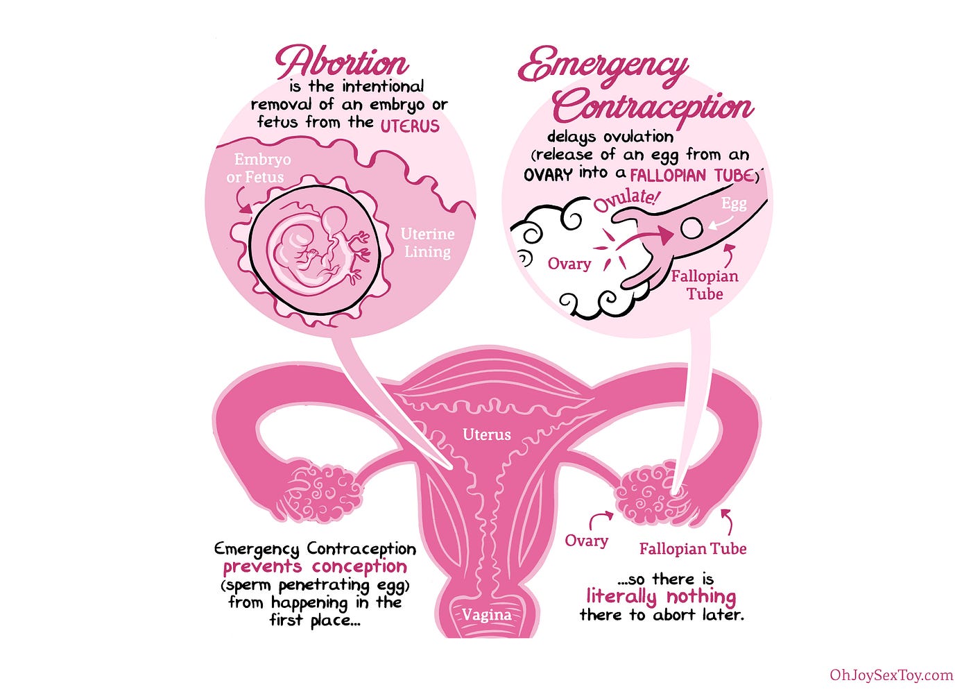 Your Guide To Emergency Contraception | by Erika Moen | The Nib | Medium