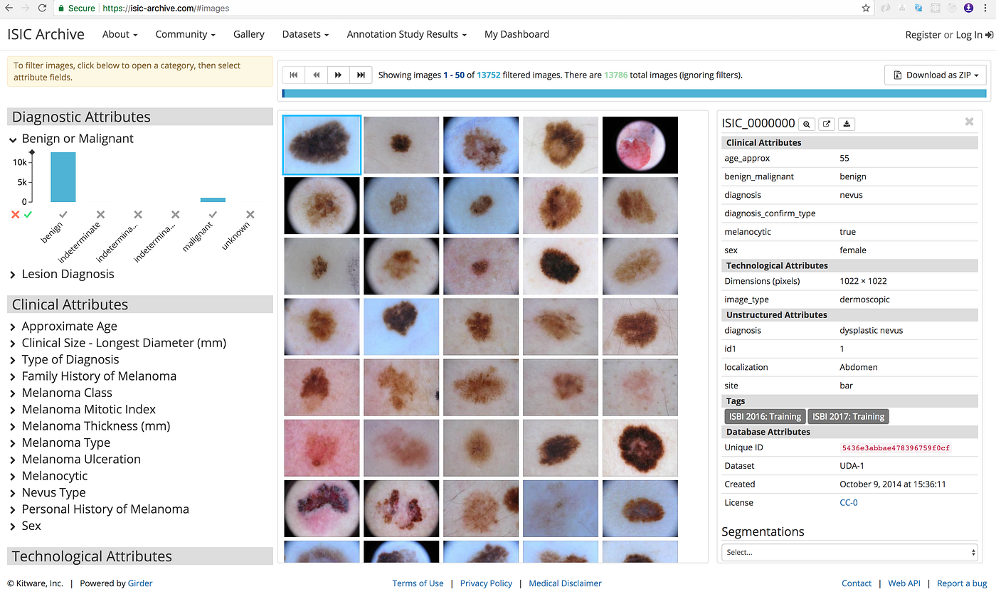 A Gentle Introduction to Machine Learning — Classification of Malignant ...