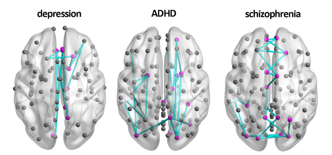 A Brief Introduction To Functional Connectomics By Mikey Taylor The Startup Medium