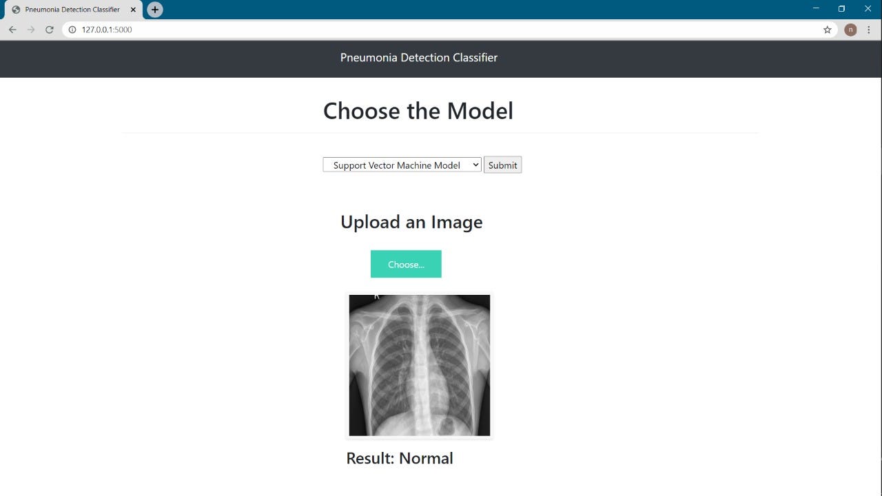 A WEB-BASED MODULE FOR IDENTIFICATION OF PNEUMONIA USING DEEP LEARNING ...