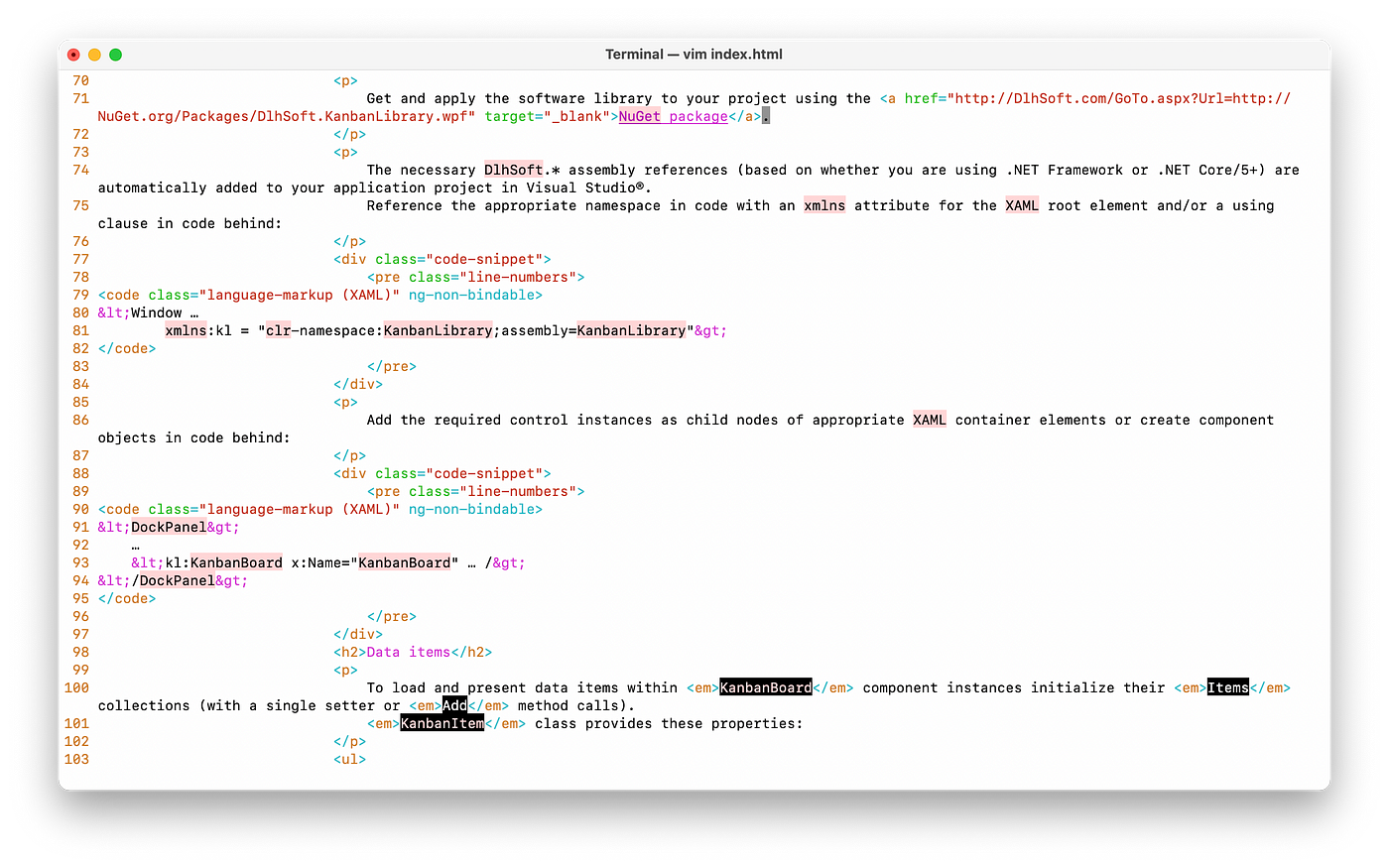 Getting Started With Vim After A Couple Of Weeks It Seems Way… By Sorin Dolha Code