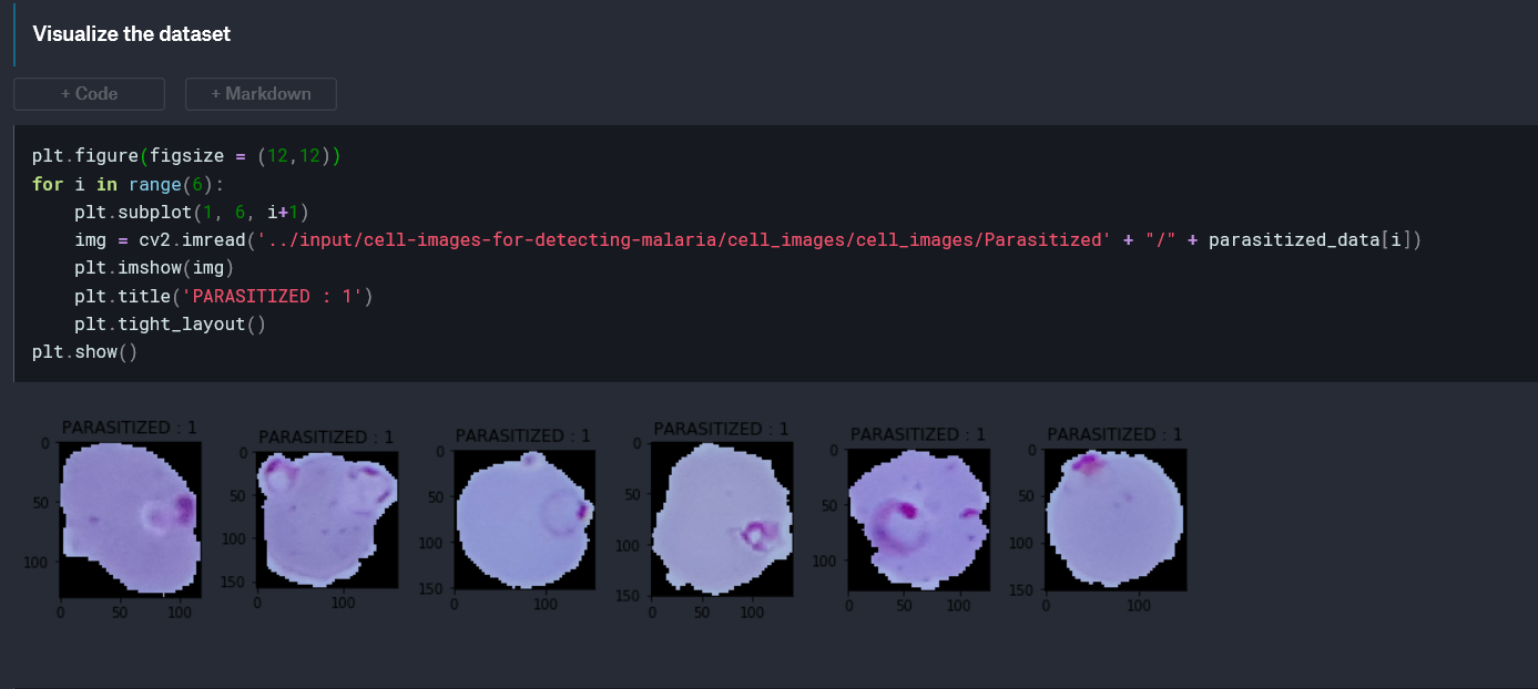 Malaria Detection in Blood Sample Images using Deep Learning | by ...