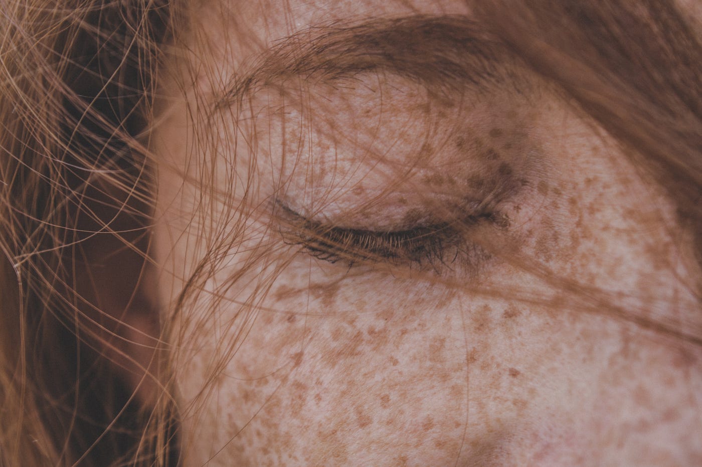 My Wife is Allergic to the Sun. She wears it on her freckles | by David ...