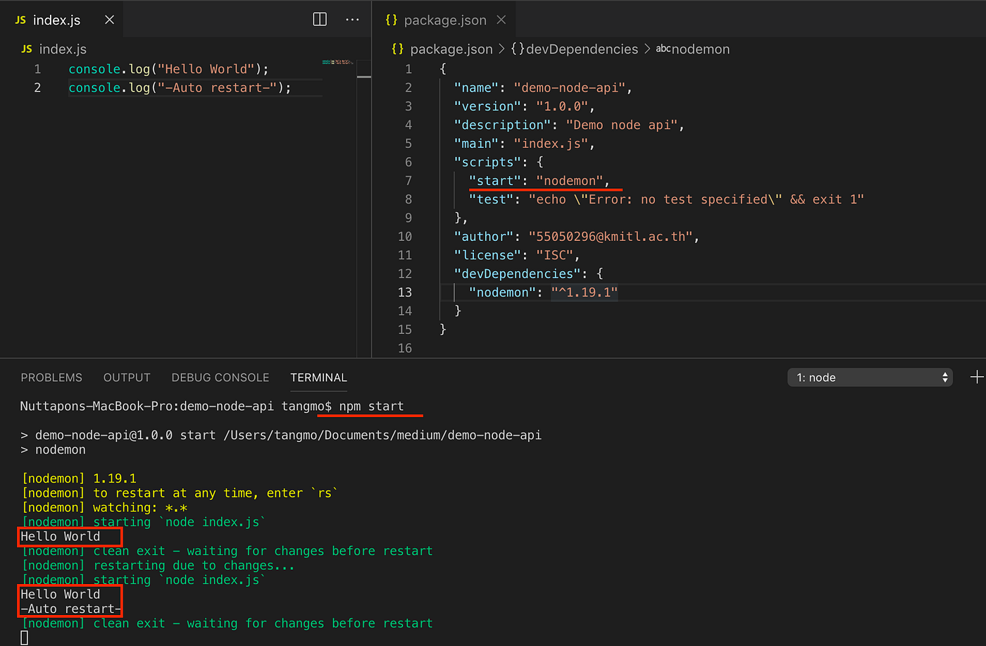 ลองสร้าง RESTfull API ด้วย Node.js ที่เขียนแบบ ORM โดยใช้ Sequelize.js [Part 1] | by Tangmo ...