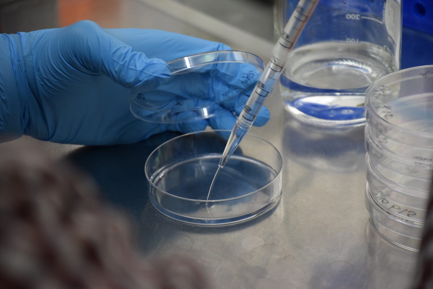 How Dr. Michael Fehlings is getting a cure for spinal cord injury a ...
