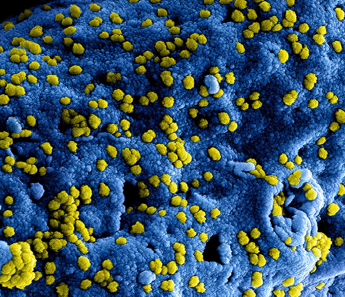 The Unknown Virus of 2019. The unknown virus of 2019 is something… | by ...