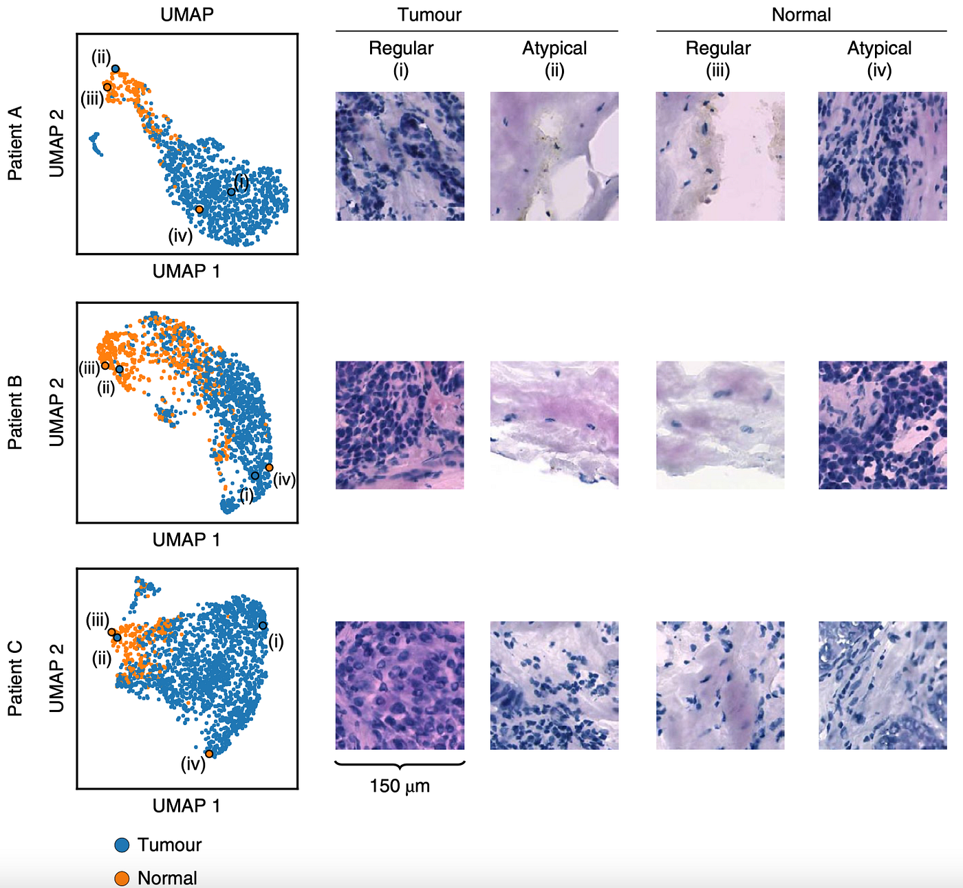 Integration of Spatial Transcriptomics and Histology images | by Joey XY | Medium