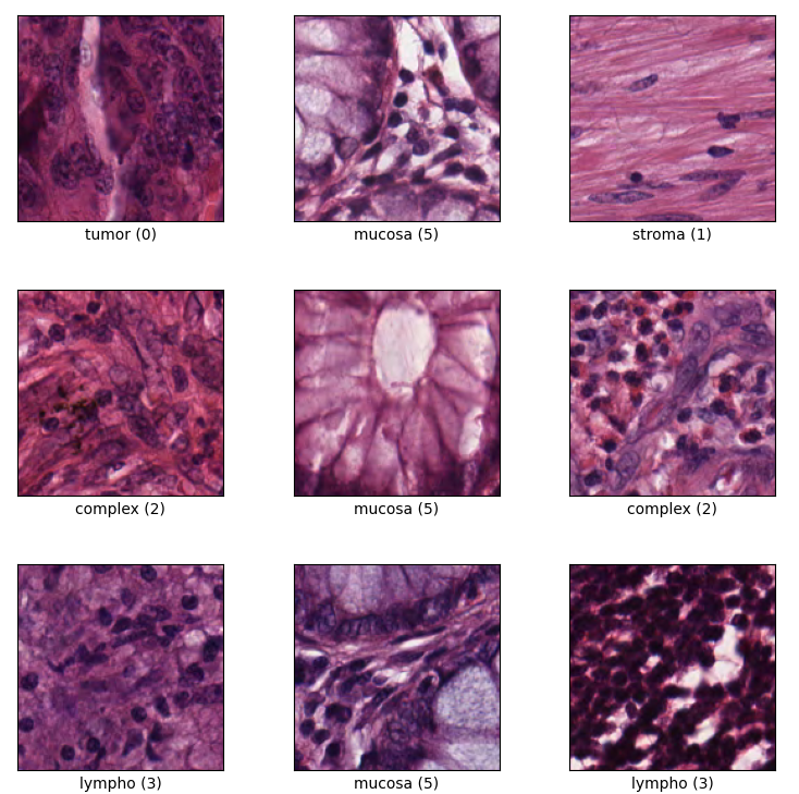 TensorFlow - Image Classification of Colorectal Cancer Histology - 92.5 ...