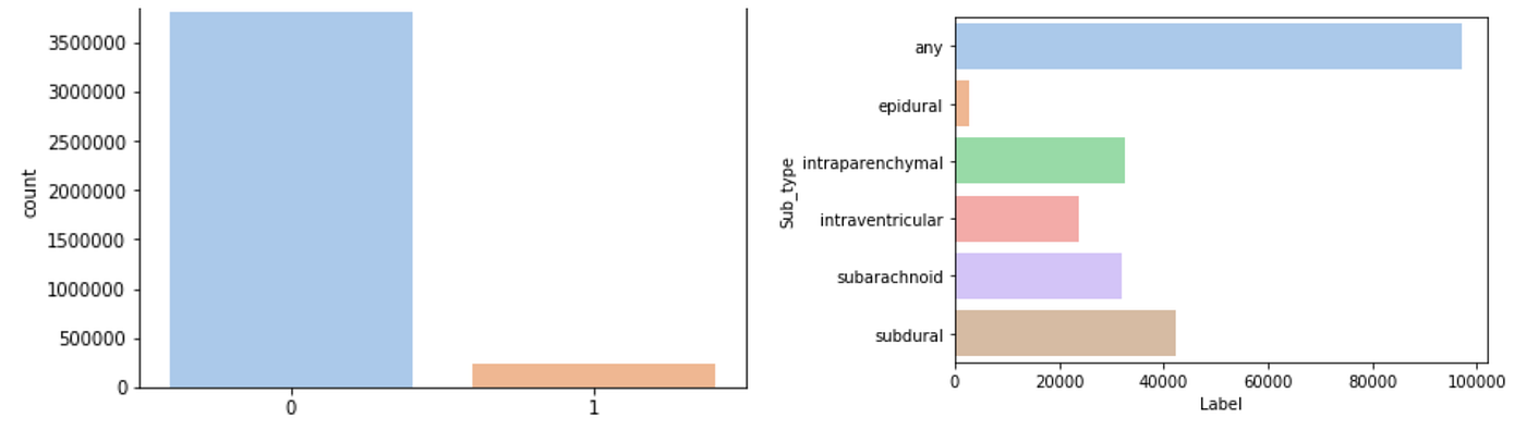Detecting And Classifying Intracranial Hemorrhage By Kelly Zhang Medium