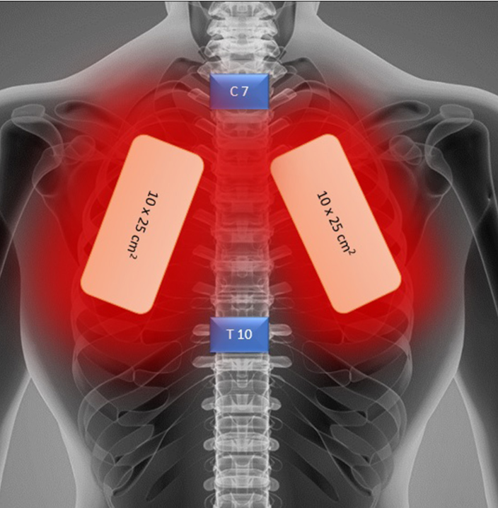 PBMT — feasible modality for the treatment of COVID-19 | by Kaiyan ...