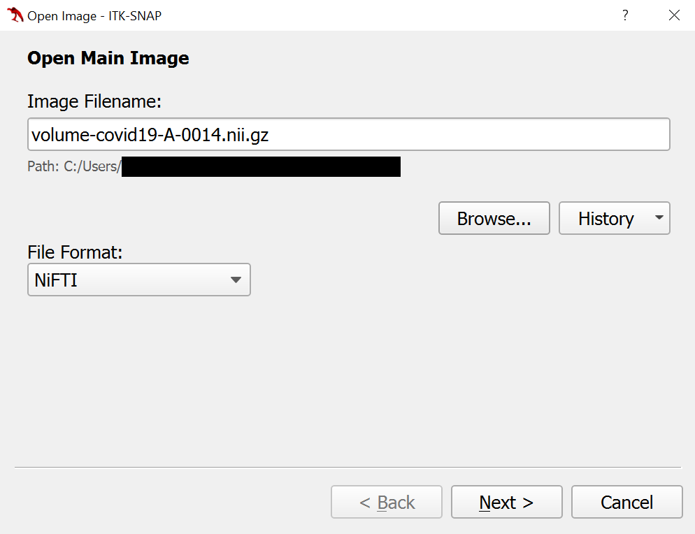 Visualize and Examine 3D Medical Images for Machine Learning Using ITK ...