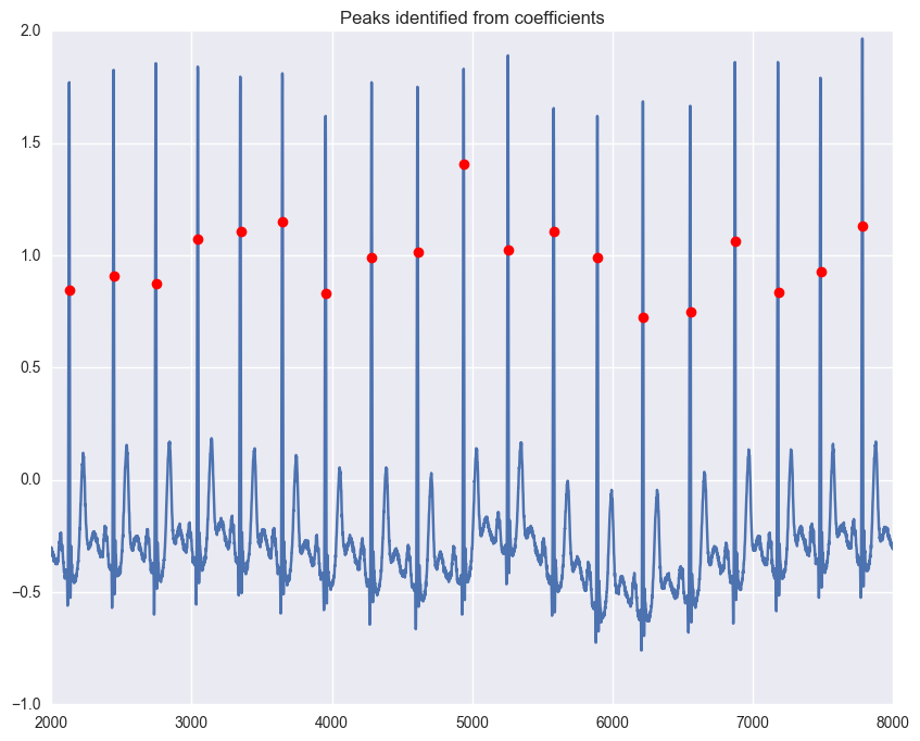 Electrocardiograms Qrs Detection Using Wavelet Analysis By Andrew Tan Medium