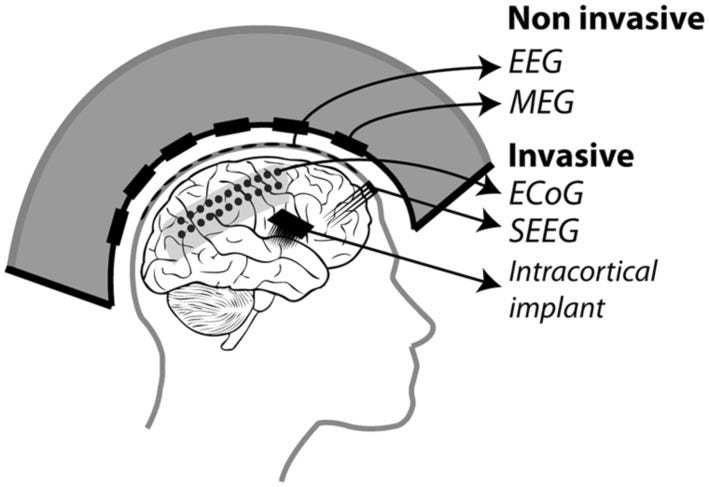 Creating Business Models for Brain-Computer Interfaces & Machine Learning