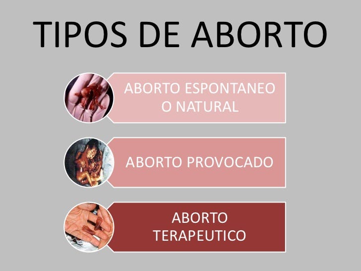 El aborto, tipos.. Este tipo de cirugía se lleva a cabo… | by Laura S ...