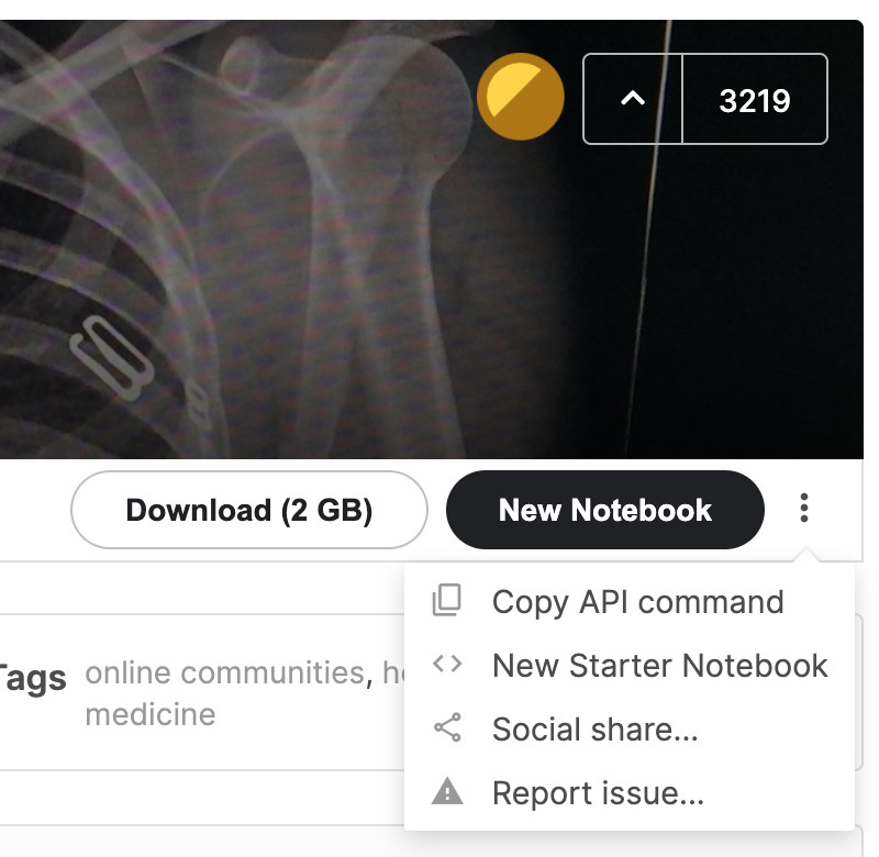 Downloading Kaggle datasets directly into Google Colab | by Anna D ...