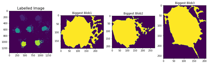 Image Processing — Blob Detection By Ralph Caubalejo Jan 2021 Towards Data Science