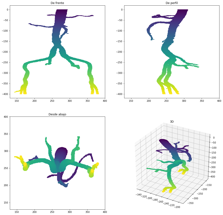 Segmentación de la arteria aorta con openCV | by Javier Abellán Abenza | Neurosapiens | Medium