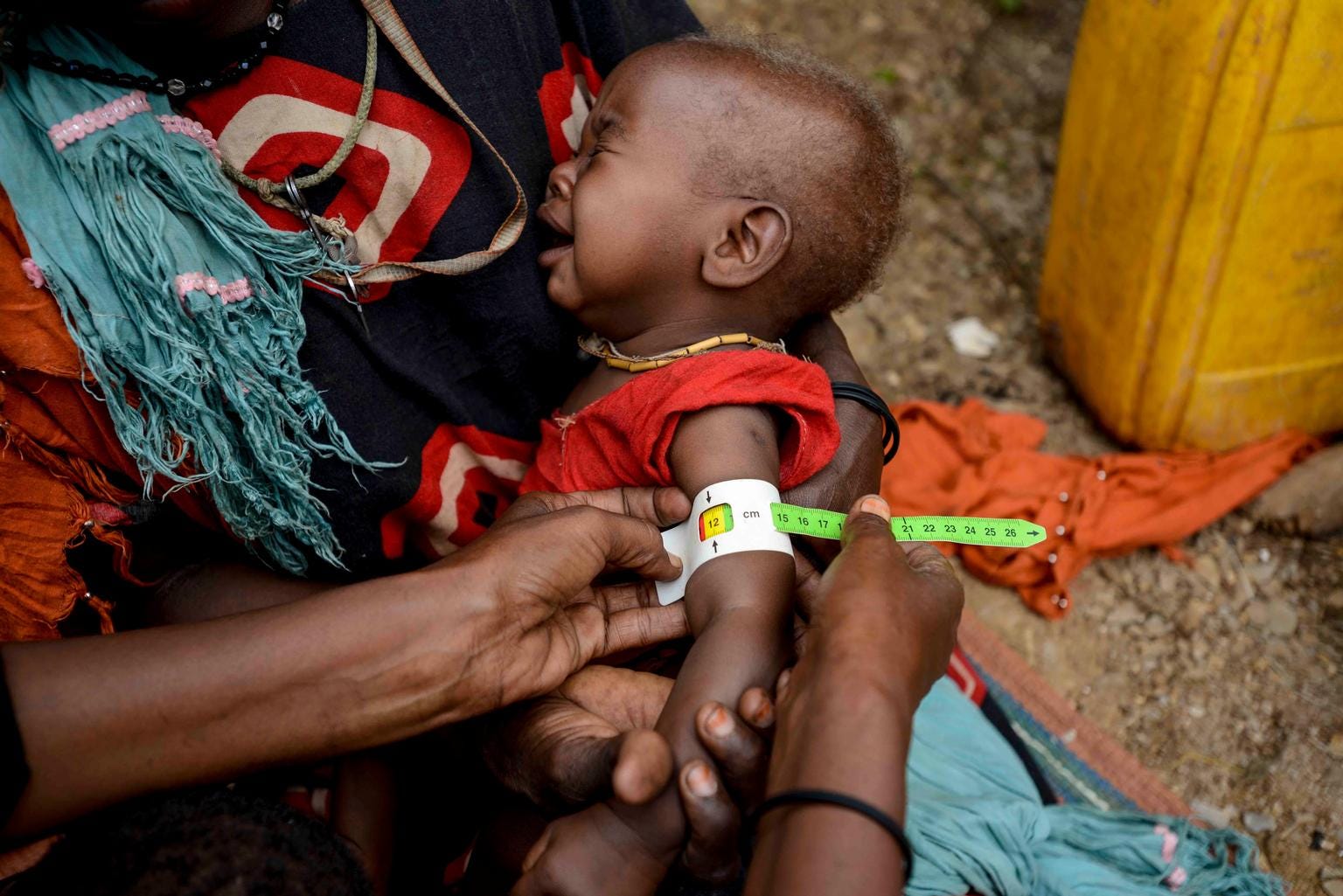 Menaced by hunger. Some 308,000 children are malnourished… | by UNICEF ...