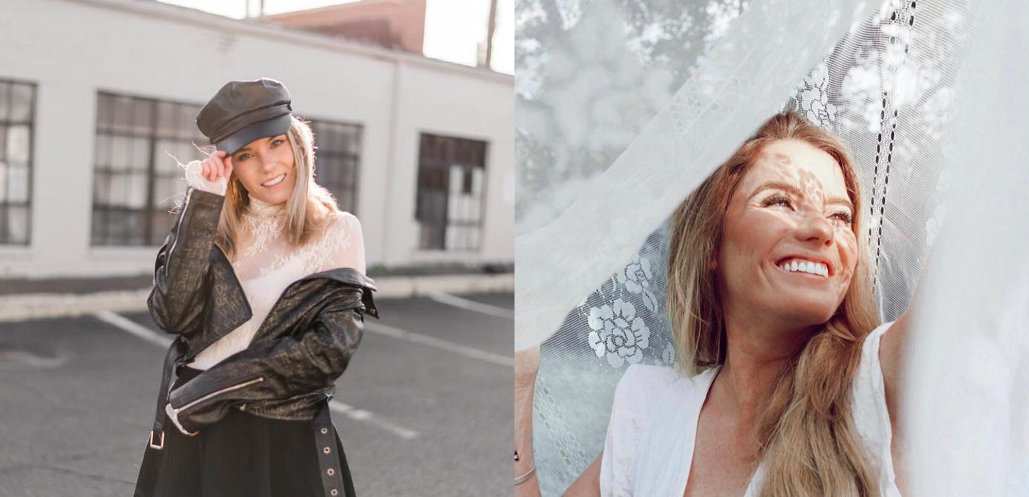 Emma Manis of EVOLVE: “I Survived An Eating Disorder And So Can You ...