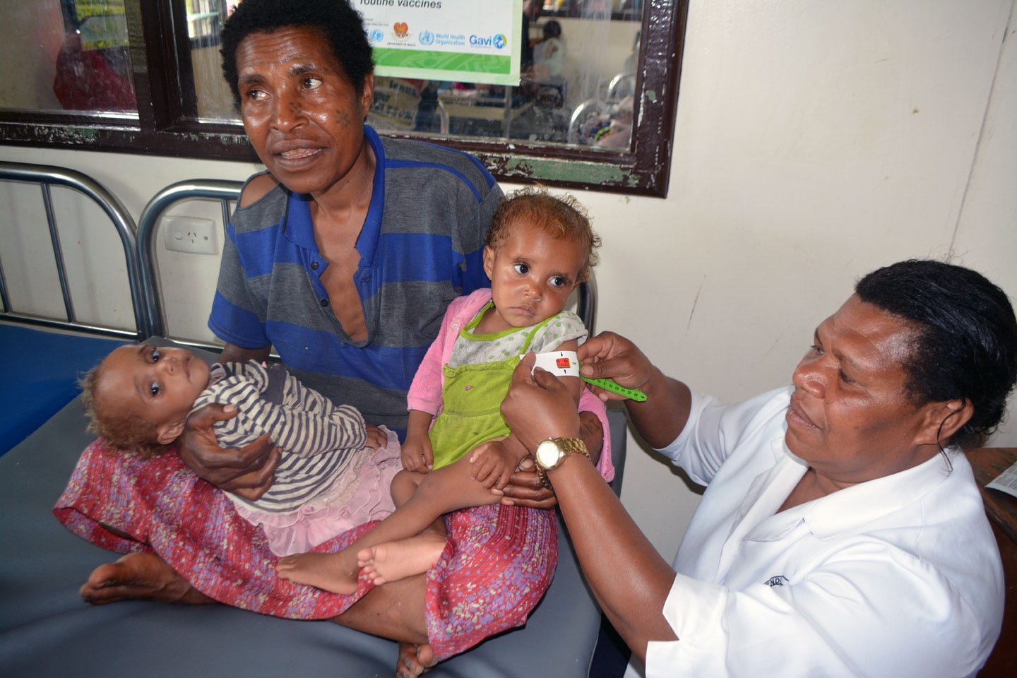 UNICEF supports prevention and treatment of severe acute malnutrition ...