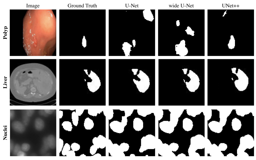Review Unet — A Nested U Net Architecture Biomedical Image Segmentation